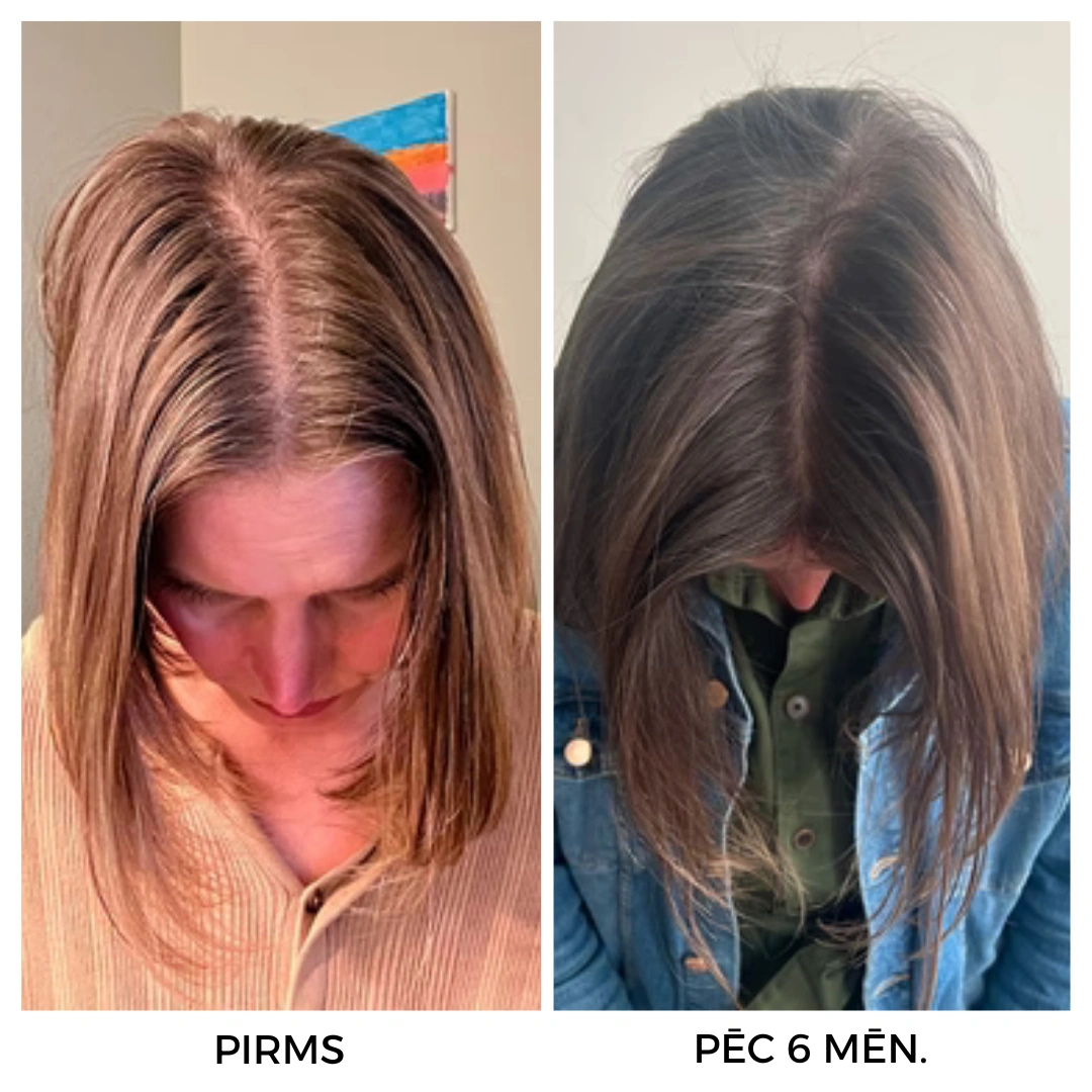 FOLLICLE ACTIVIN – unikāls folikulus aktivizējošs serums ar 5x augstāku ...
